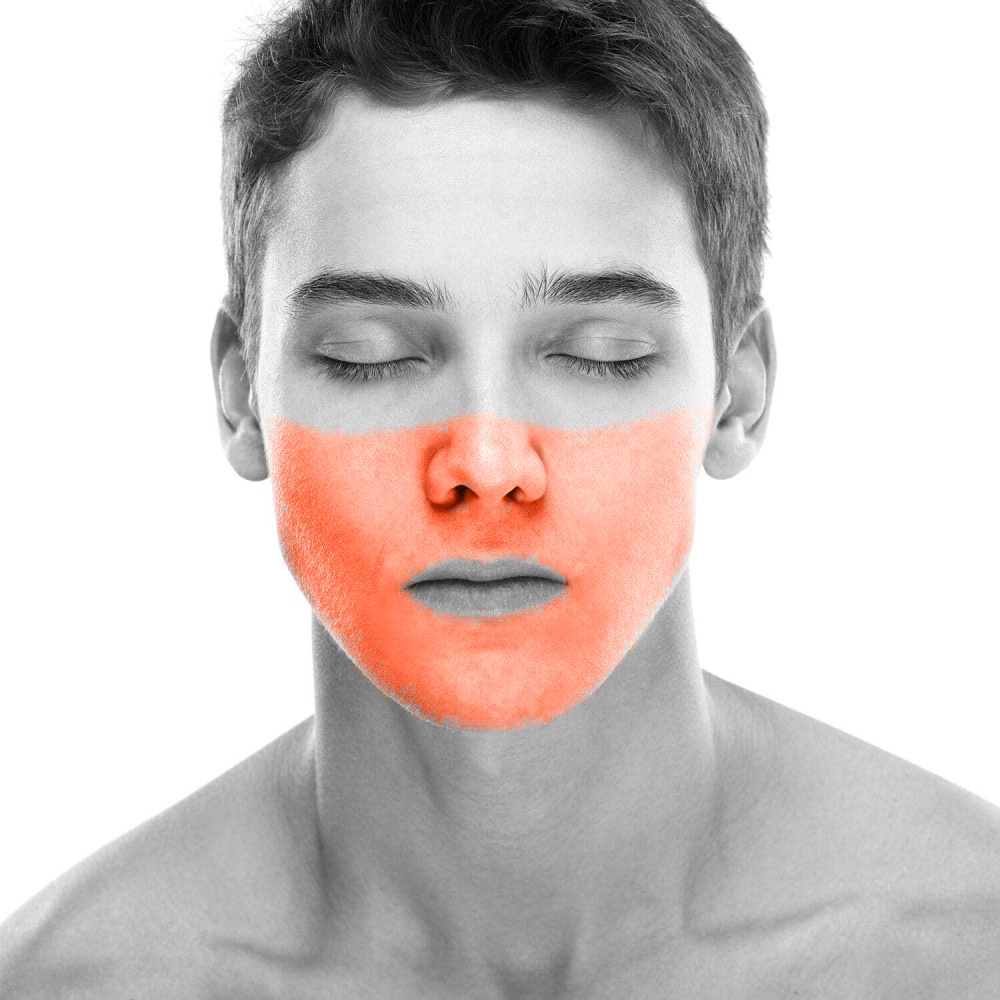 Beard Laser Hair Removal For Men in NYC – Infinity Laser Spa