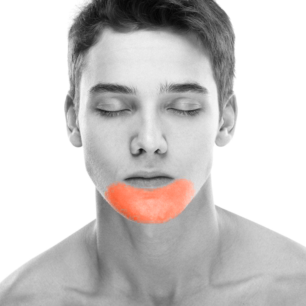 Extended Chin Laser Hair Removal For Men in NYC – Infinity Laser Spa