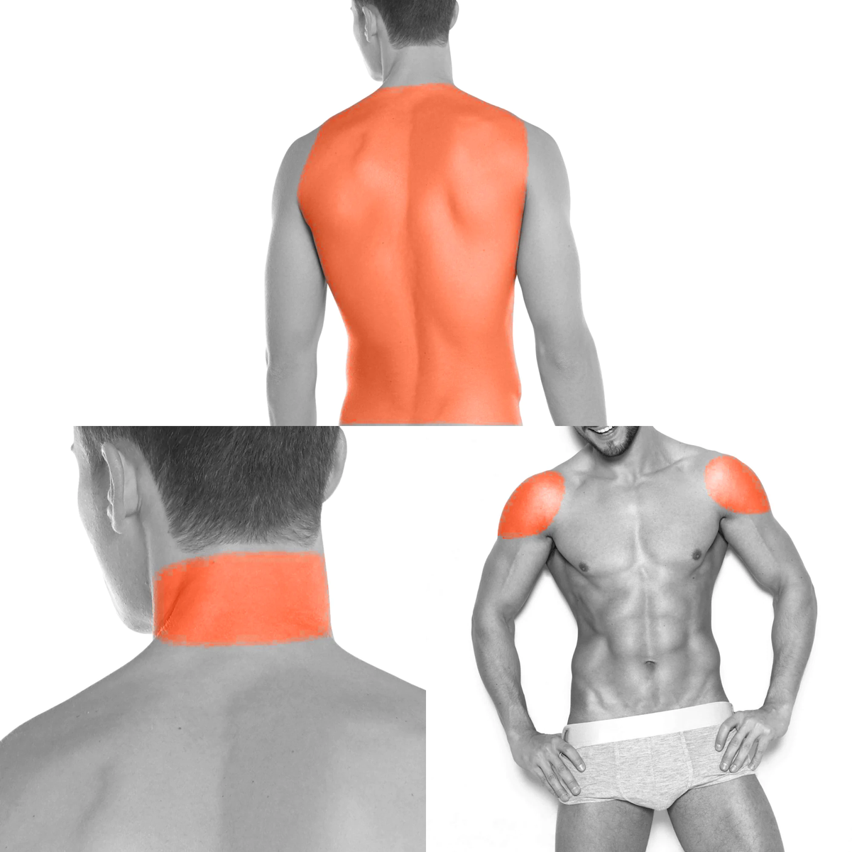 Full Back, Shoulders & Back of Neck Laser Hair Removal for Men (6 Sess ...